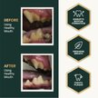 VETRISCIENCE Perio Support Healthy Mouth Clinically Tested Dental ...